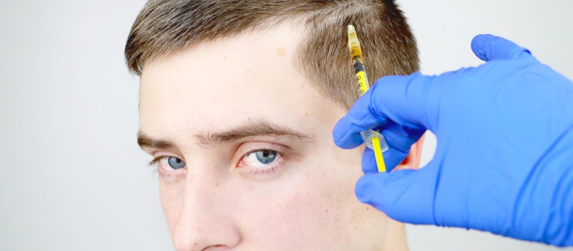 Mesotherapy for Hair Loss: Revitalize Your Locks Naturally ...